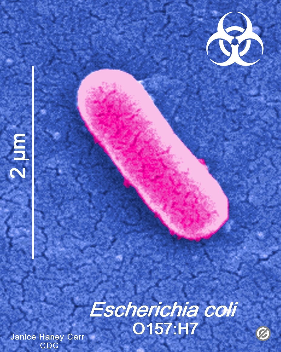 FSA released revised E.coli O157 control of cross-contamination ...